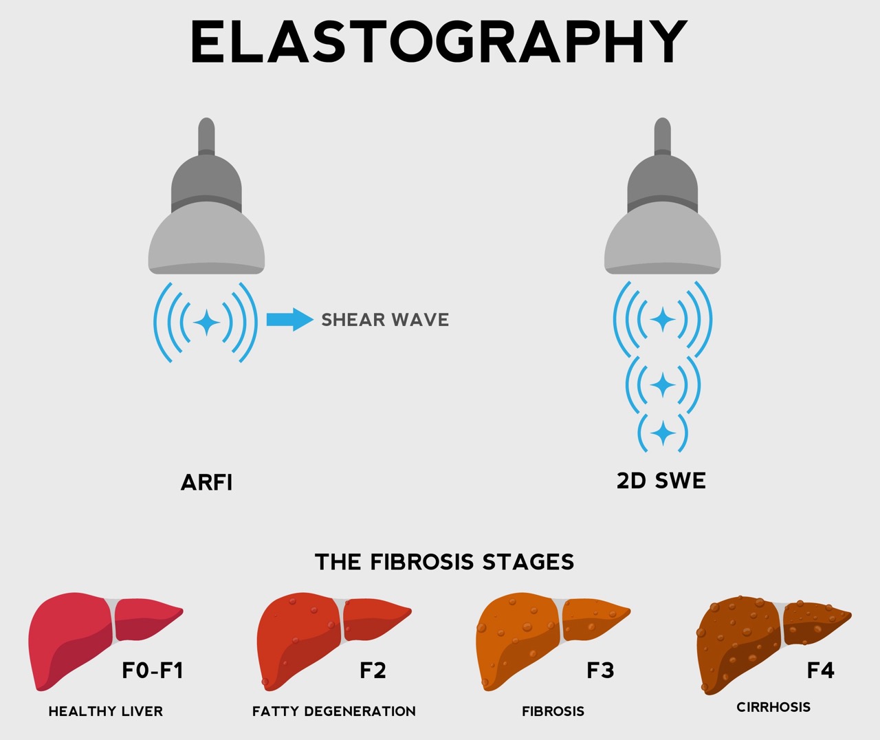 Liver Shearwave Elastography - London Private Ultrasound